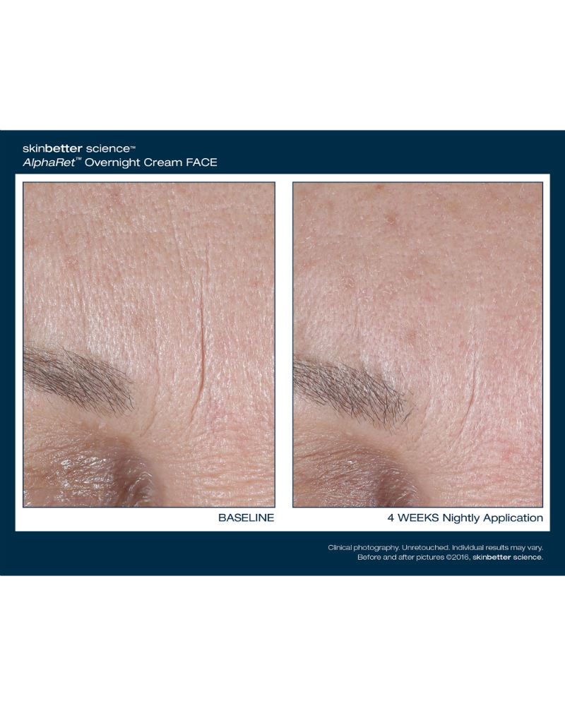 Intensive AlphaRet® Overnight Cream FACE, 30 ml - TOP CLINIC ...